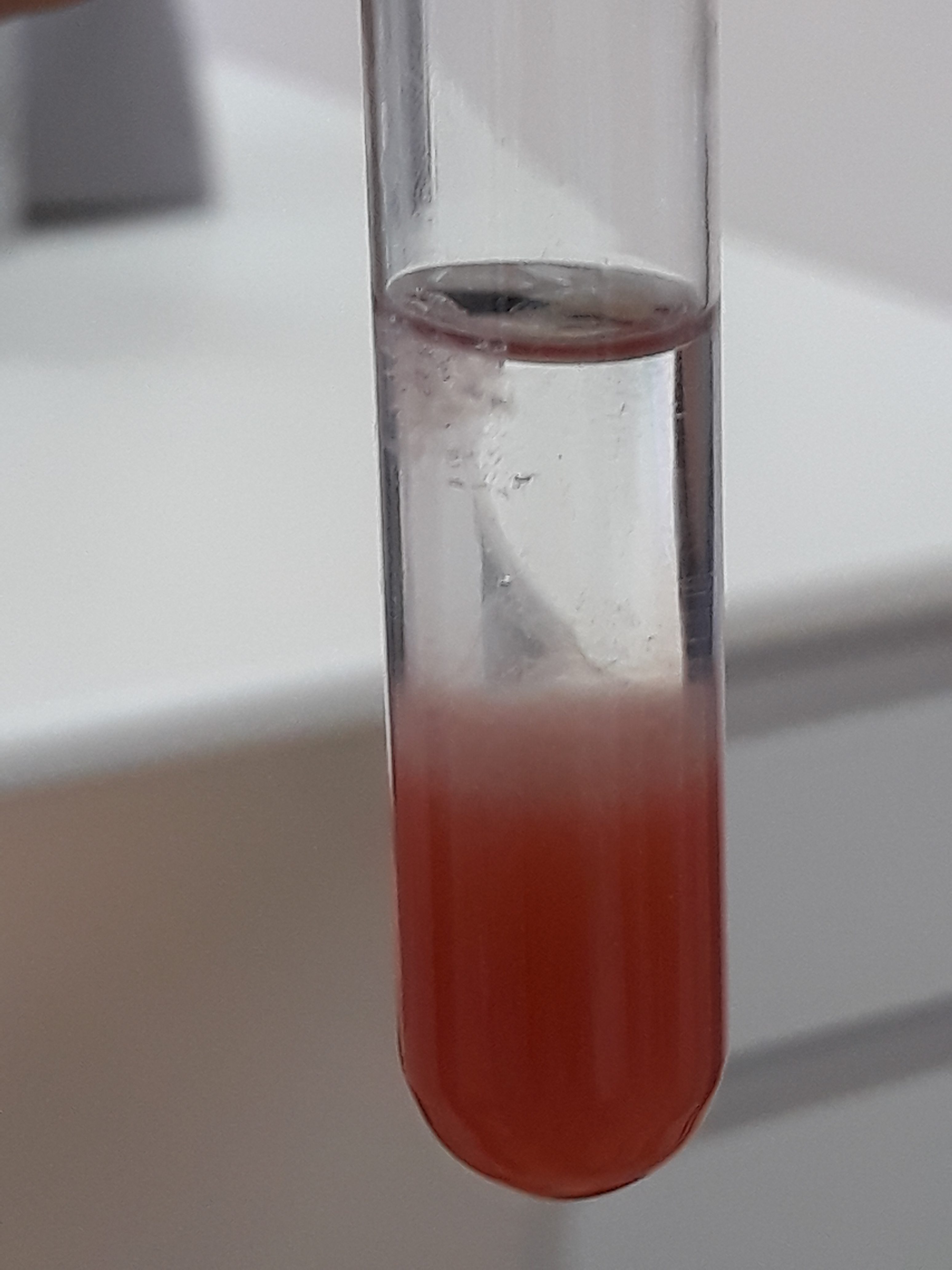 Extracción De Adn De Fresas